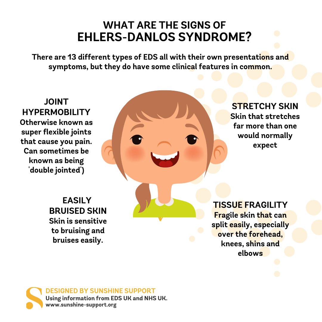 EDS - Free Download - Sunshine Support