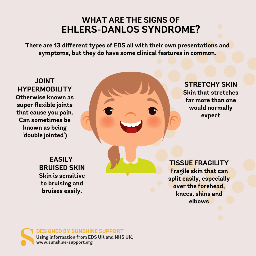 Signs of Ehlers-Danlos Syndrome: Free Download - Sunshine Support
