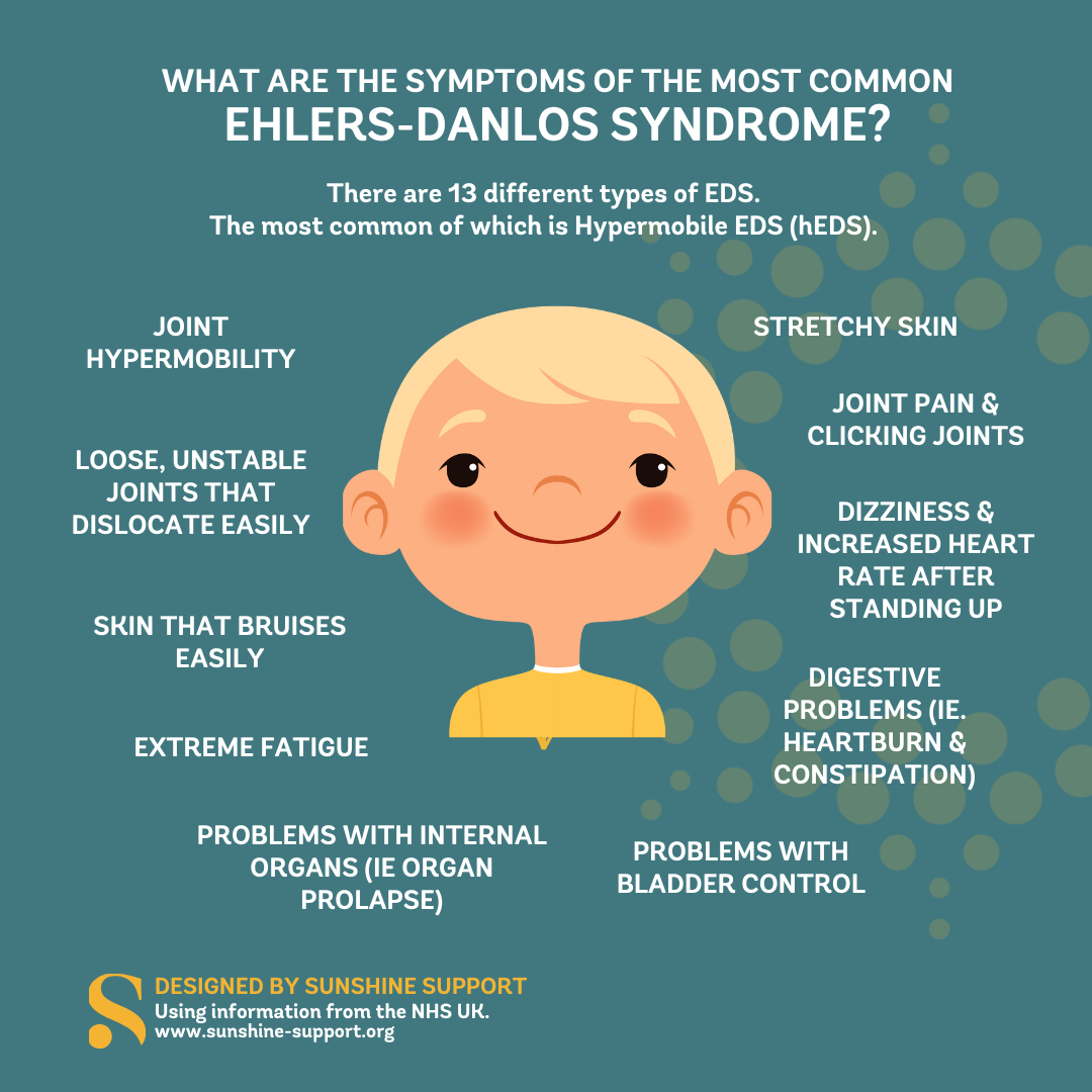 Symptoms Hypermobile Ehlers-Danlos Syndrome (HEDS): Free Download ...